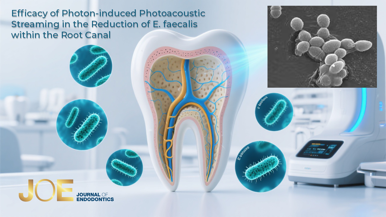 Efficacy of Photon-induced Photoacoustic Streaming in the Reduction of E. faecalis within the ...